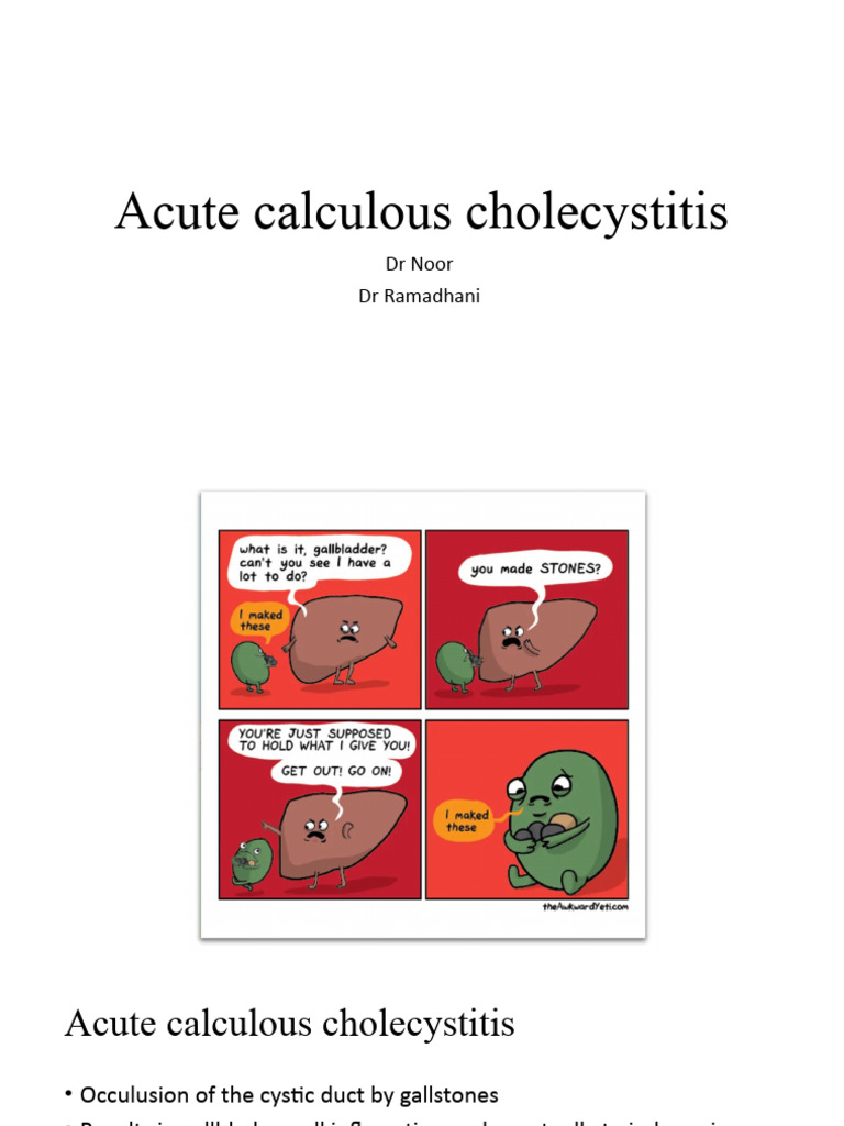 Acute Cholecystitis | PDF | Gallbladder | Medicine
