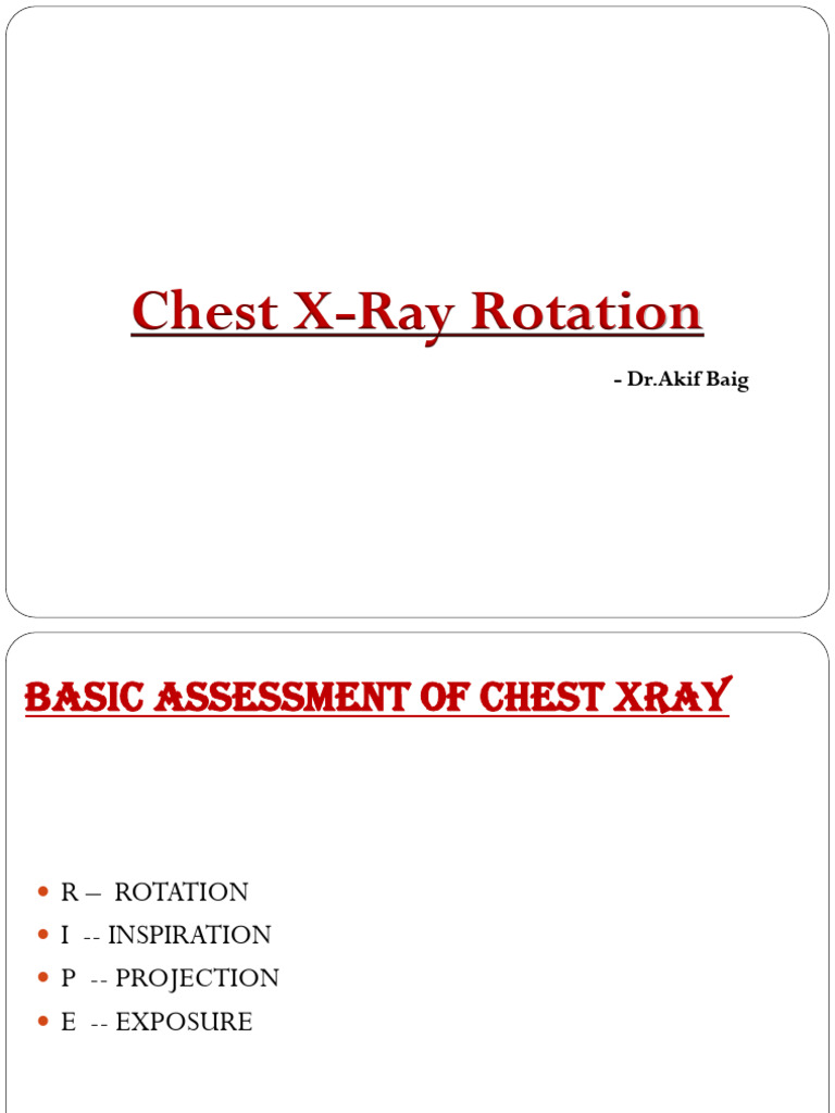 Chest Xray Rotation | PDF