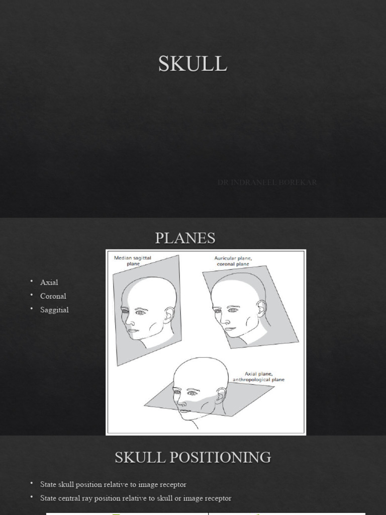 Skull | PDF | Skull | Human Nose
