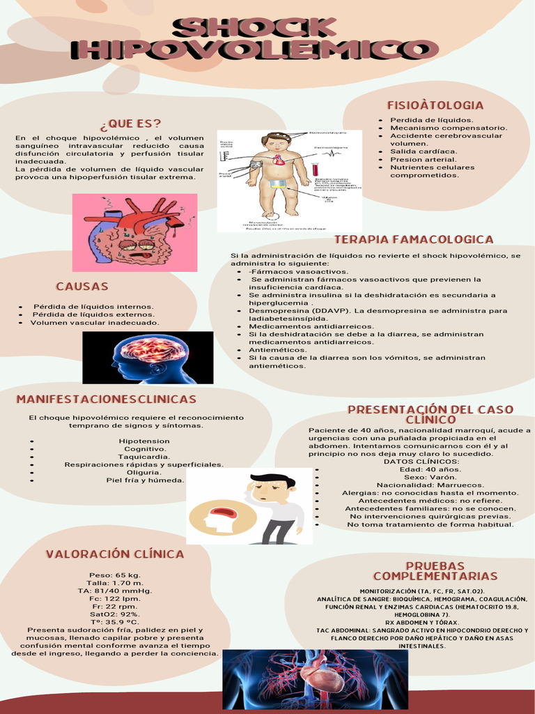 Shock Hipovolemico-2 | PDF | Choque (circulatorio) | Enfermedades y ...