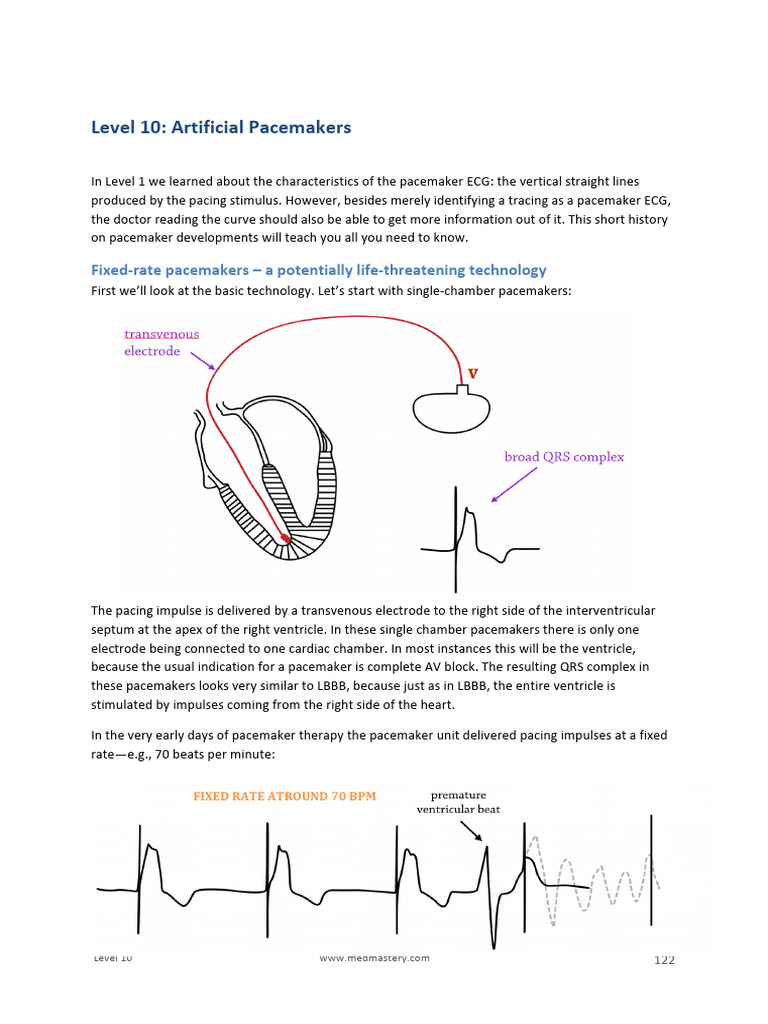 Pacemakers - Fact Sheet | PDF | Artificial Cardiac Pacemaker | Atrium ...