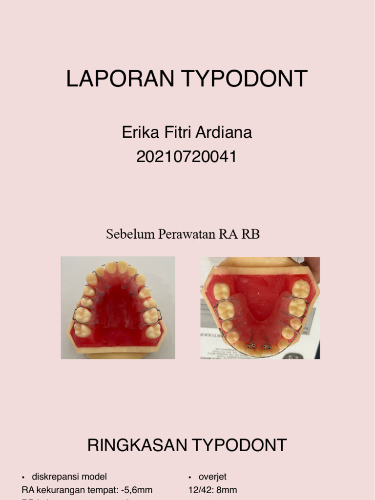 Laporan Typodont | PDF