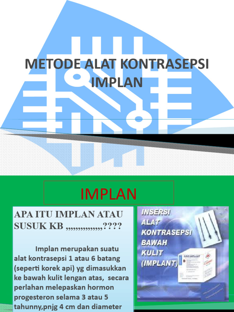Alat Kontrasepsi Implan | PDF
