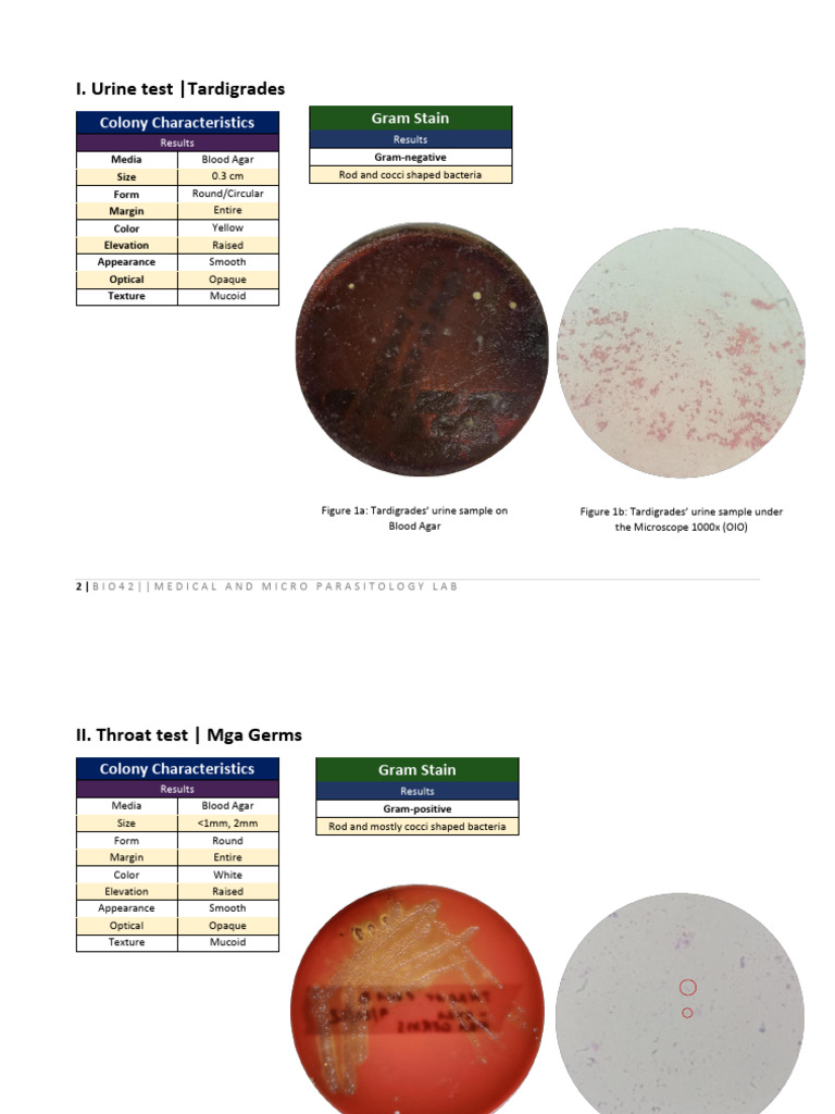 MMP URINE AND THROAT TEST Results and Observation - Removed | PDF ...