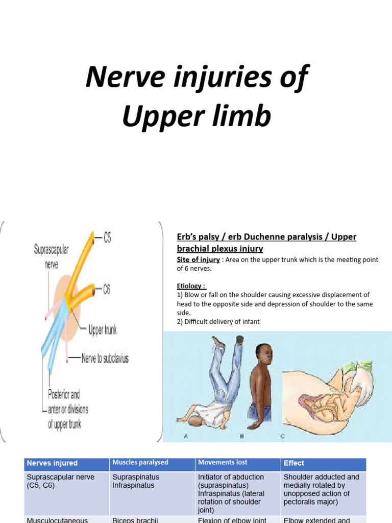 Nerve Injuries of Upper Extremity | PDF | Thumb | Hand
