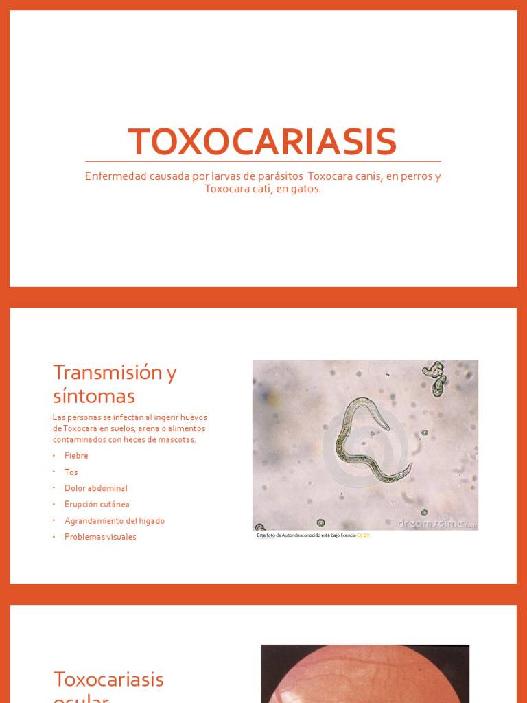 Toxocariasis: Síntomas y Prevención | PDF