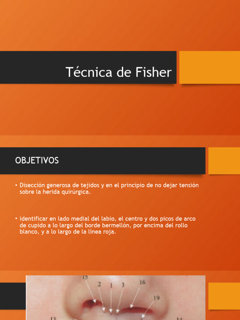 Presentacion Fisher | PDF