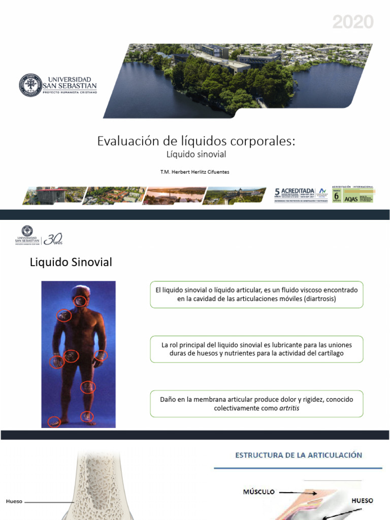Evaluación del líquido sinovial articular | PDF | Inflamación ...