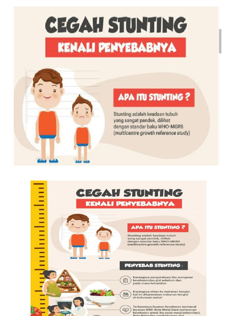 Stunting | PDF
