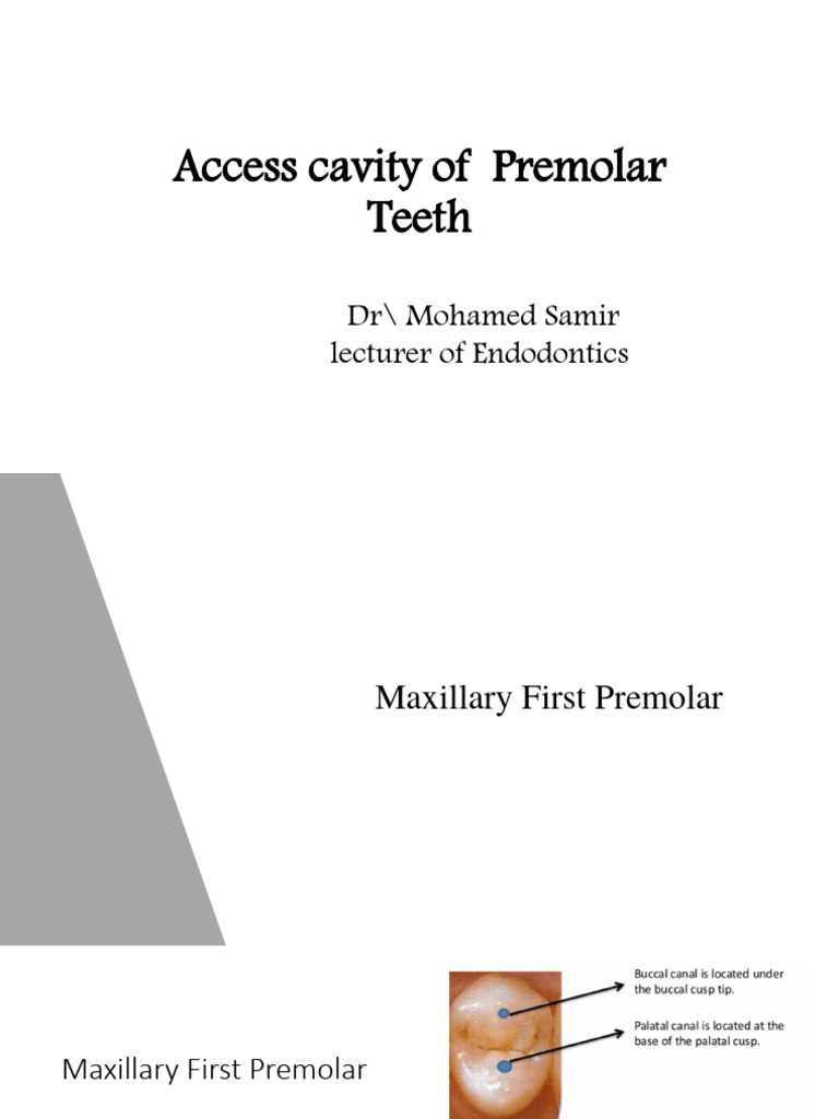 Premolar Access Cavity Preparation Guide | PDF | Tooth | Dentistry Branches