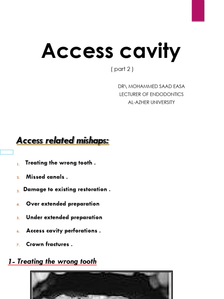 Access Cavity Part 2 | PDF | Dentin | Tooth