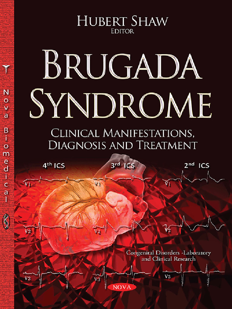 Brugada Syndrome Clinical Manifestations Diagnosis and Treatment | PDF ...