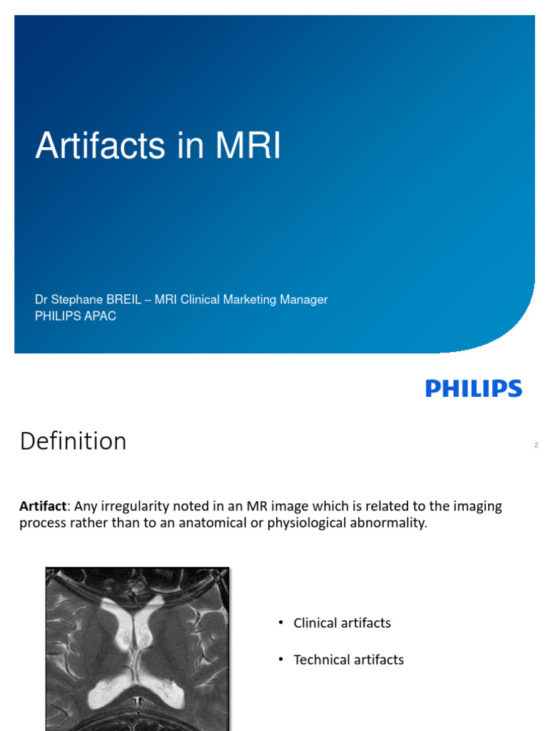 MRI Artifacts: Types and Solutions | PDF | Magnetic Resonance Imaging