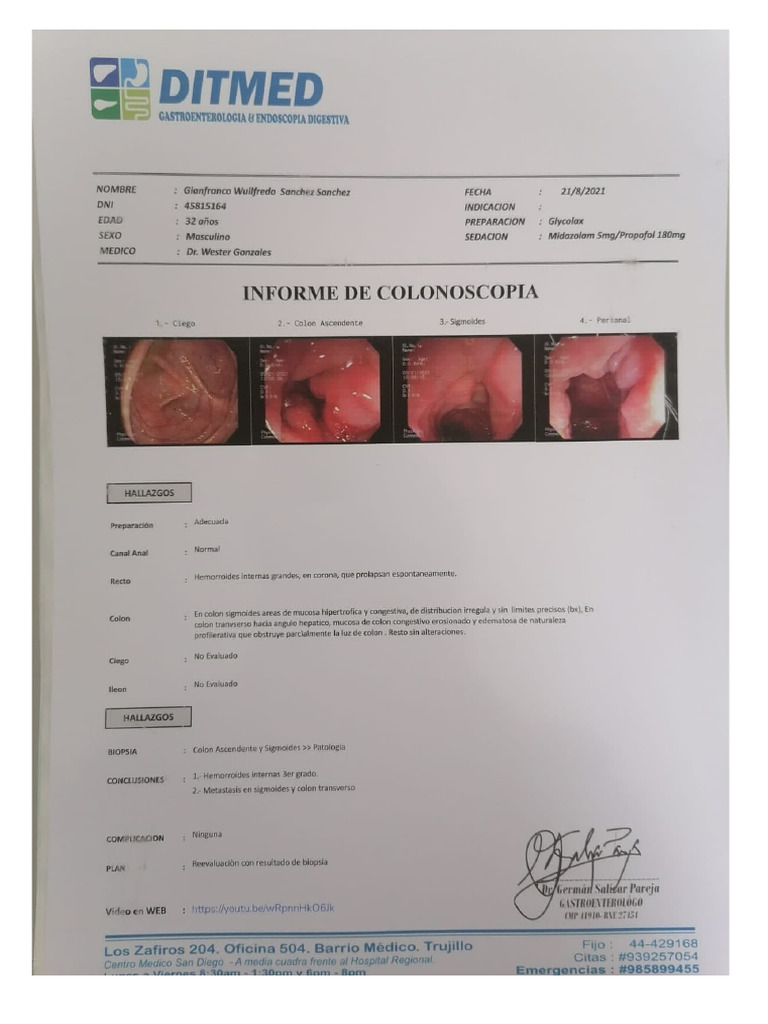 SANCHEZ COLONOSCOPIA | PDF