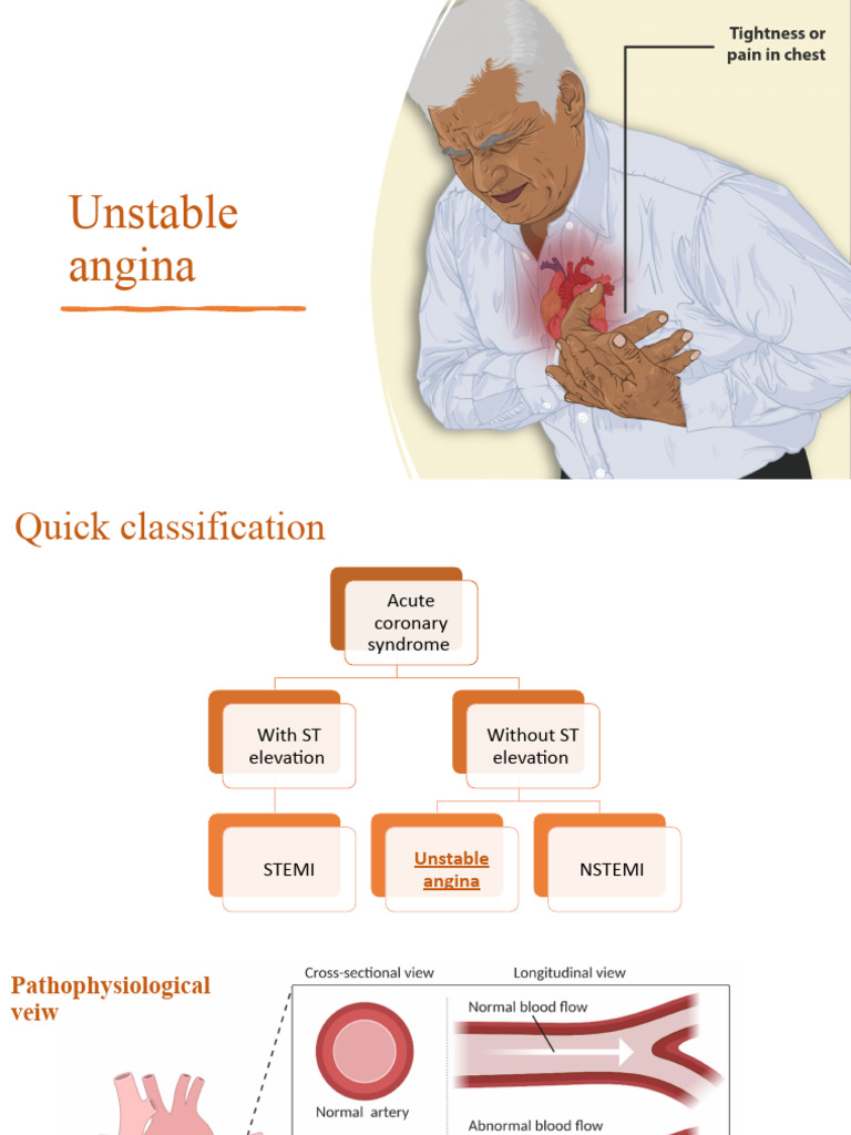unstable angina | PDF | Myocardial Infarction | Coronary Artery Disease