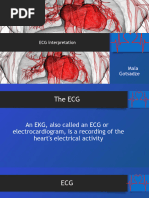 Normal ECG Checklist PDF | PDF | Electrocardiography | Circulatory System