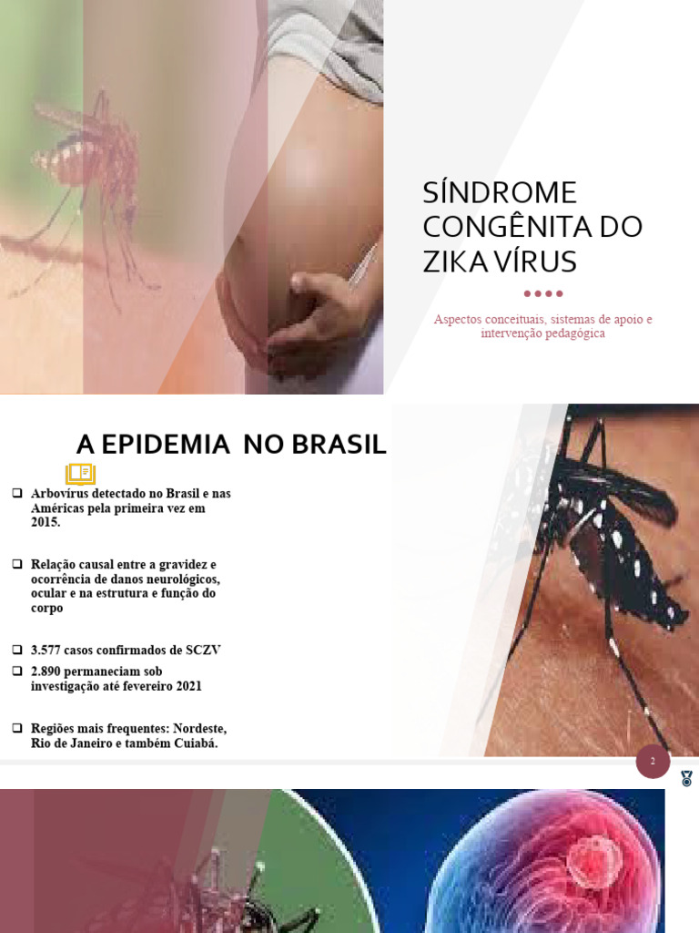 Síndrome Congênita Do Zika Vírus Pdf Vírus Da Zika Especialidades