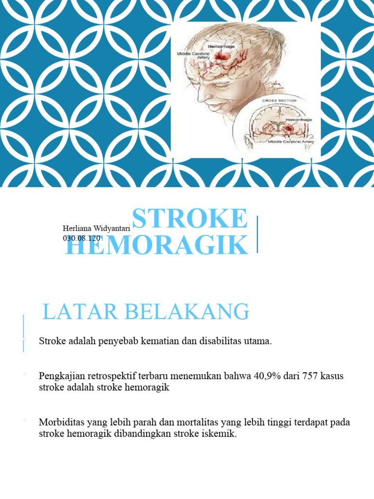 Stroke Hemoragik | PDF | Sains & Matematika