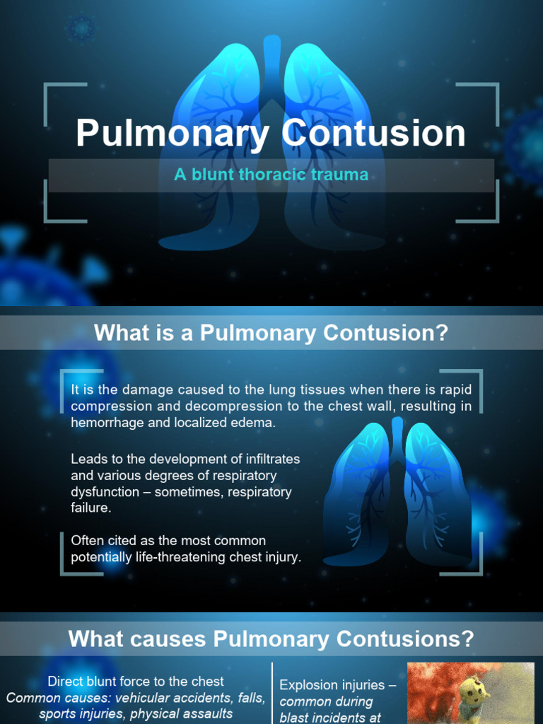 Understanding Pulmonary Contusion | PDF | Lung | Injury