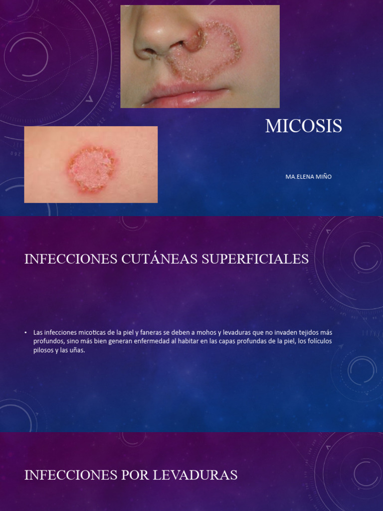 Micosis Pdf Epidemiología Micología