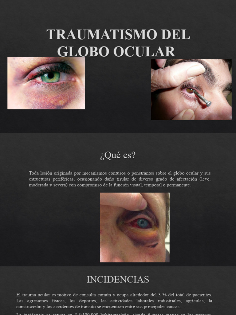 Traumatismo Del Globo Ocular | PDF | Ojo humano | Lesión