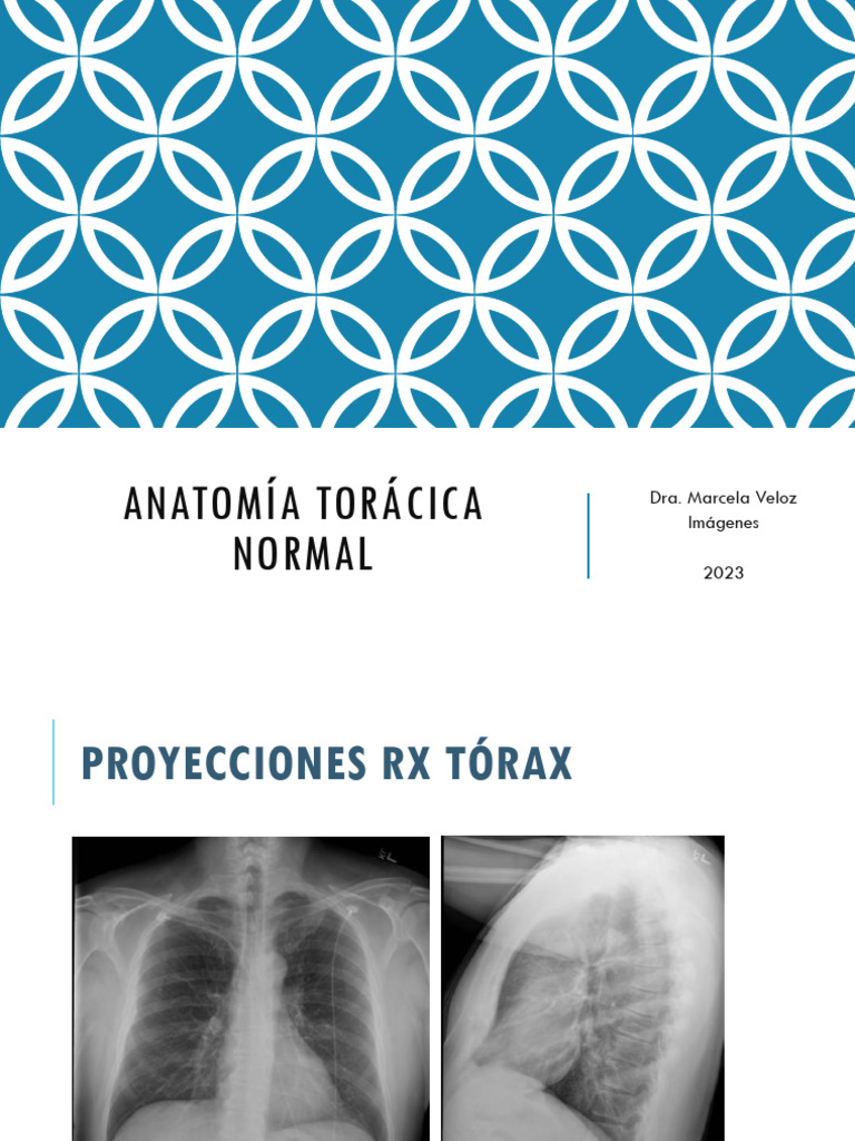 CLASE 2 Identificación Anatomía Pulmonar Normal 2023 | PDF | Pulmón ...