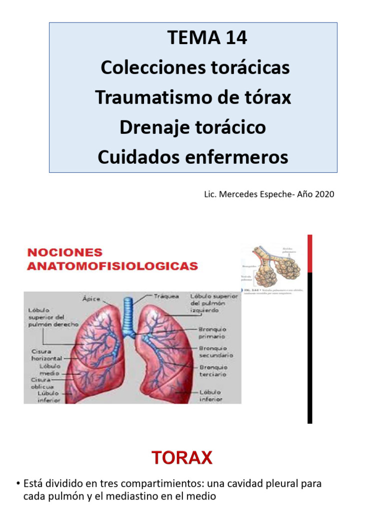 Traumatismo de Tórax | PDF | Pulmón | Lesión