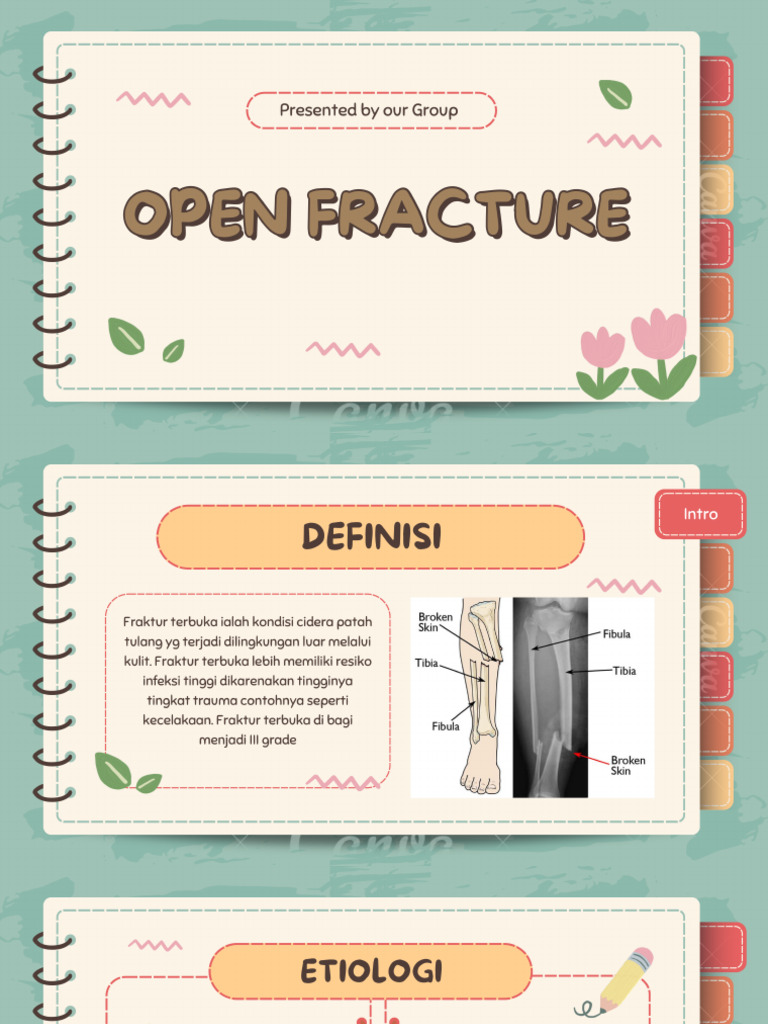#An3 Open Fracture | PDF