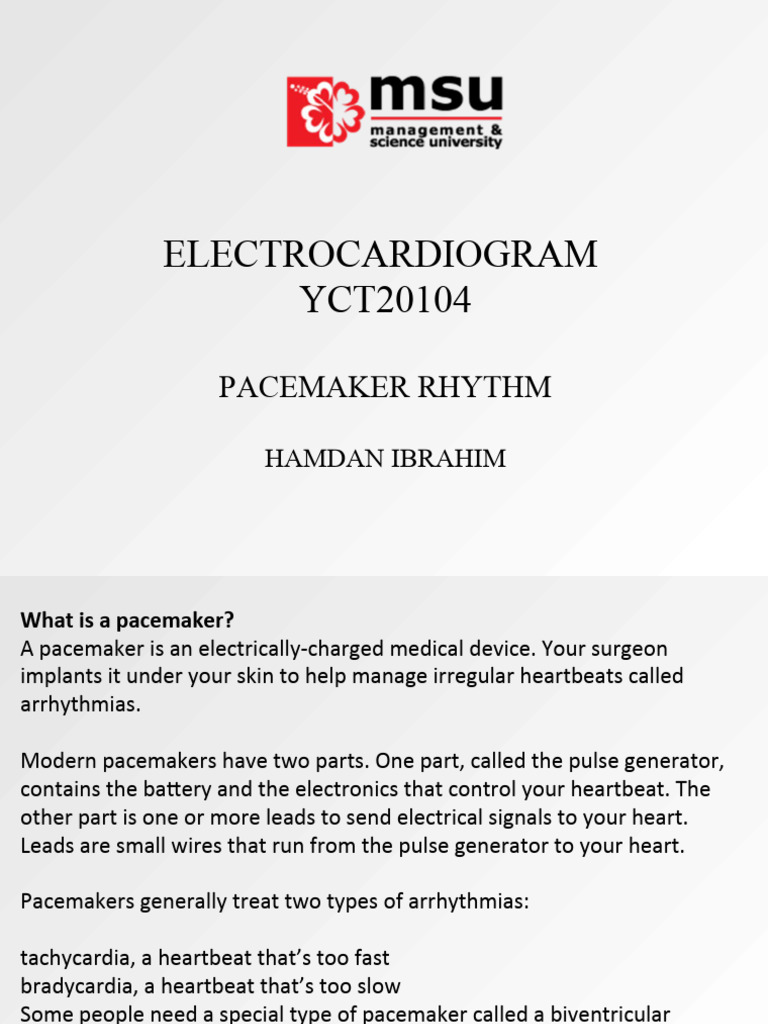 Pacemaker | PDF | Artificial Cardiac Pacemaker | Heart