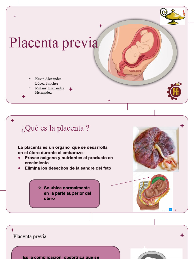 Placenta Previa | Descargar gratis PDF | Feto | El embarazo