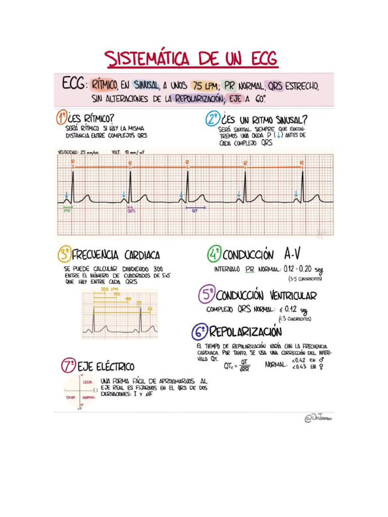 Imprimir EKG | PDF