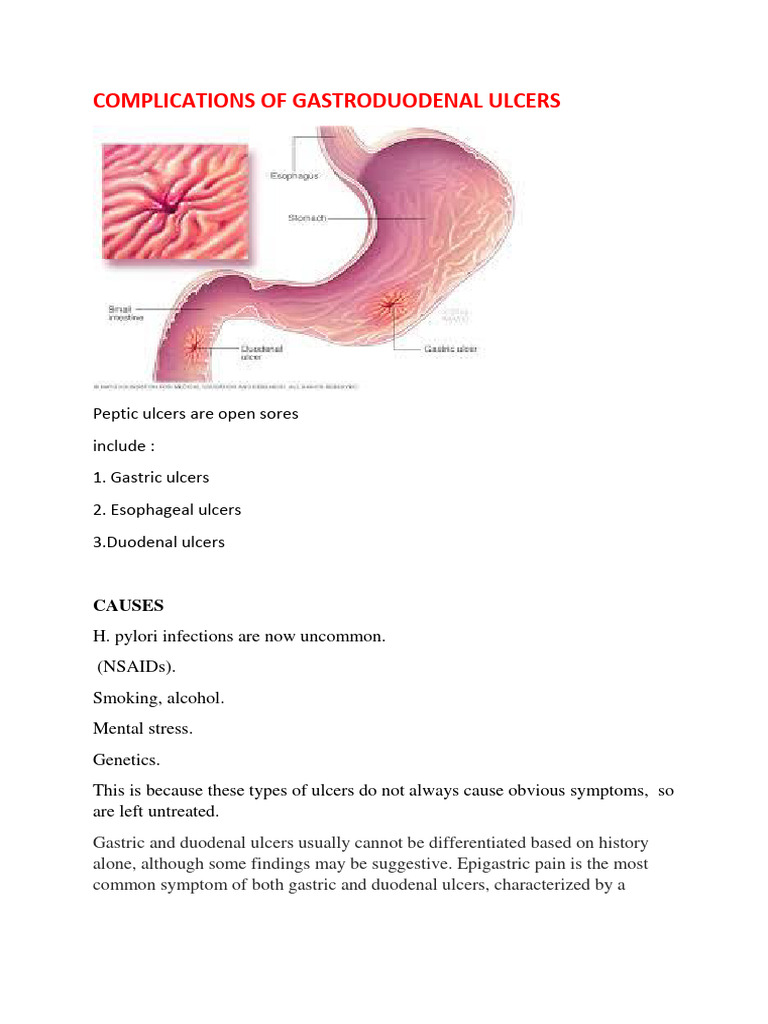 Material Study Complications Gastro-Duodenal Ulcers | PDF | Esophagus | Digestive Diseases