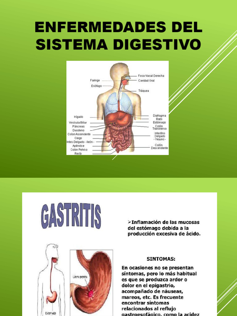 Enfermedades Del Sistema Digestivo | PDF | Diarrea | Aspirina