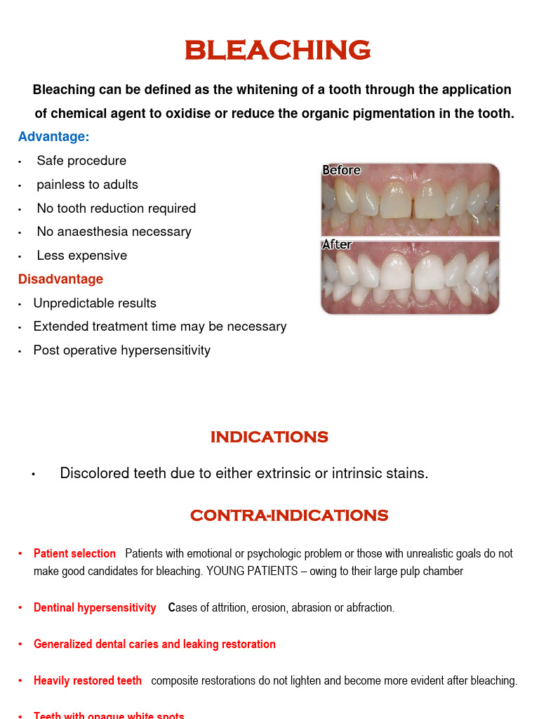 Bleaching | Download Free PDF | Bleach | Tooth Enamel
