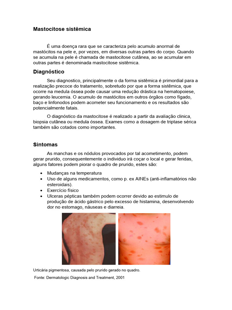 Mastocitose Sistêmica | PDF | Medicina Clínica | Doenças e distúrbios
