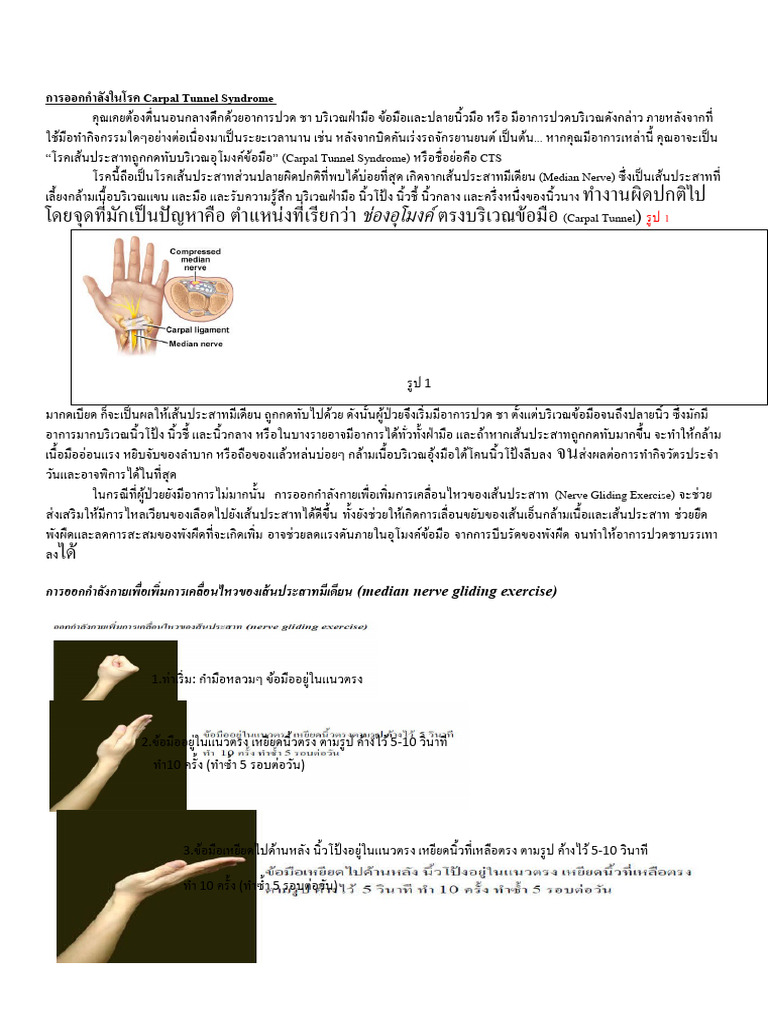 Nerve gliding exercise in CTS | PDF