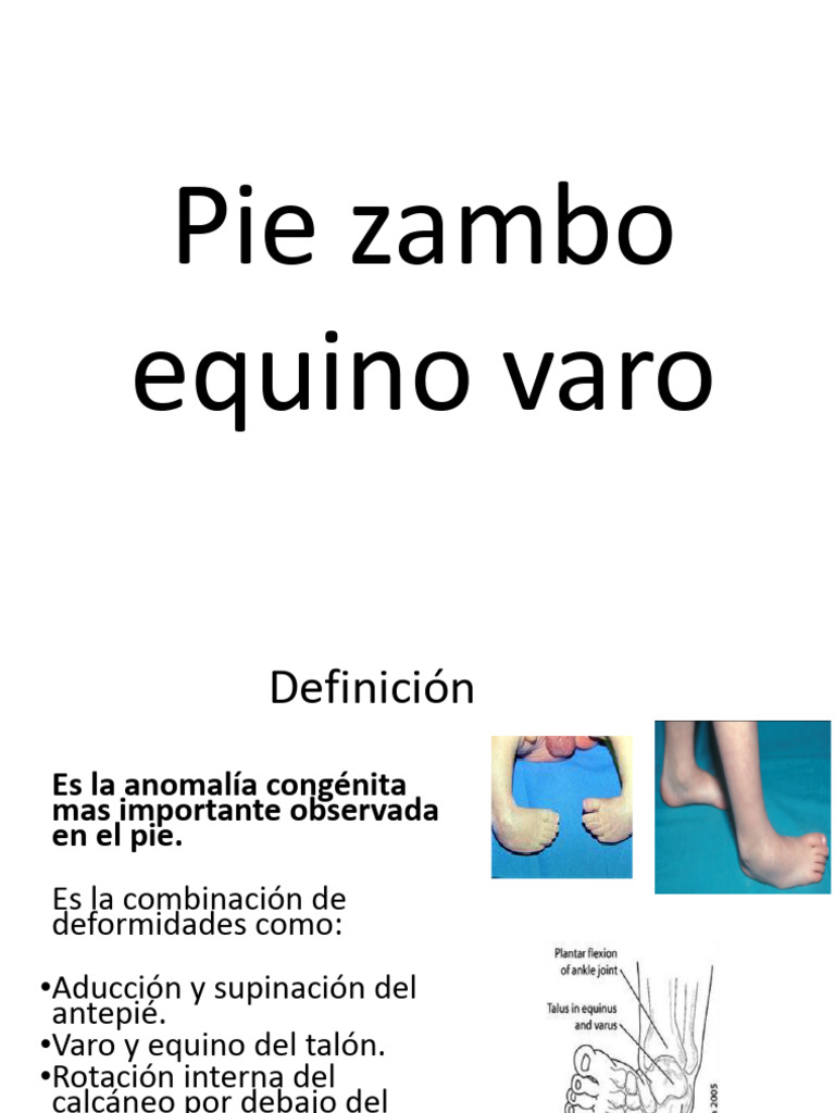 Tema 23 Pie Zambo Equino Varo | PDF | Pie | Rodilla