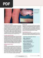 Dermatitis Atopica GPC | PDF | Alergia | Inmunología