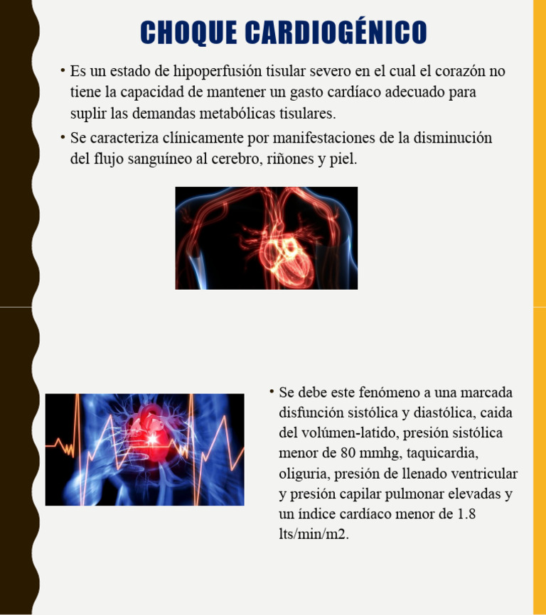 U1 1.5 Choque Cardiogénico | PDF