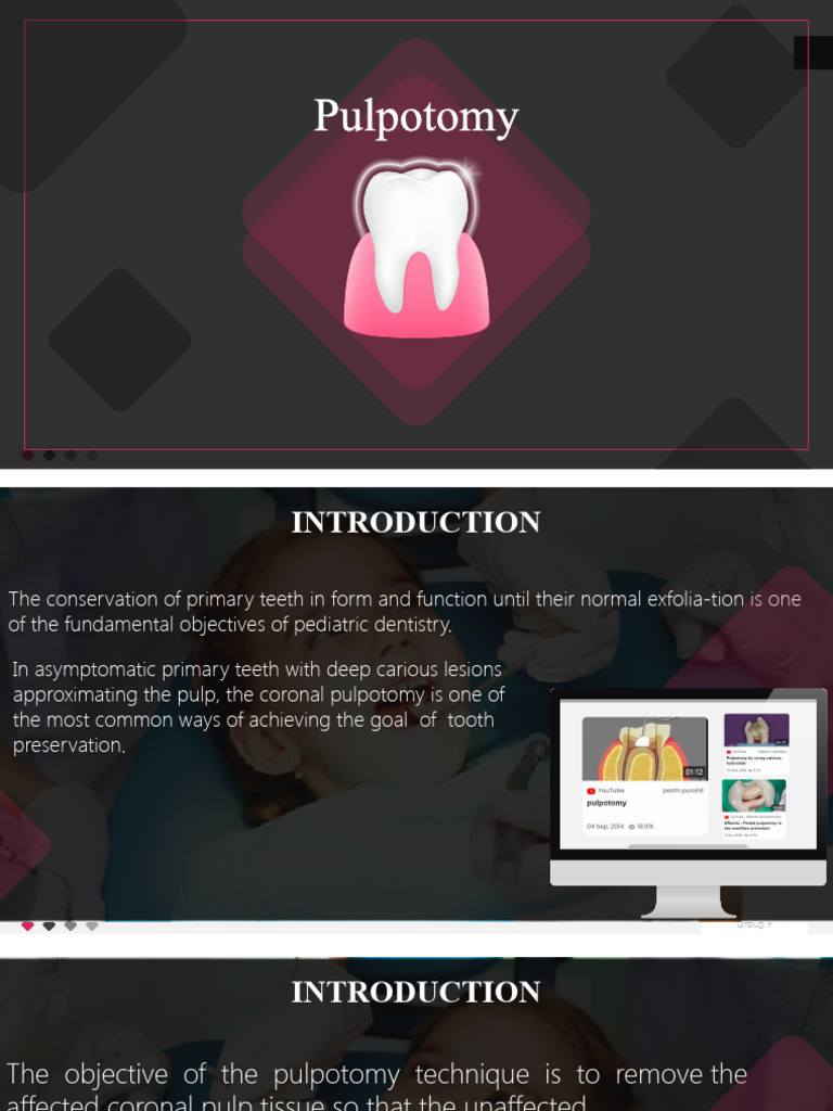 Pulpotomy in Dentistry | PDF | Dentistry | Dental Anatomy