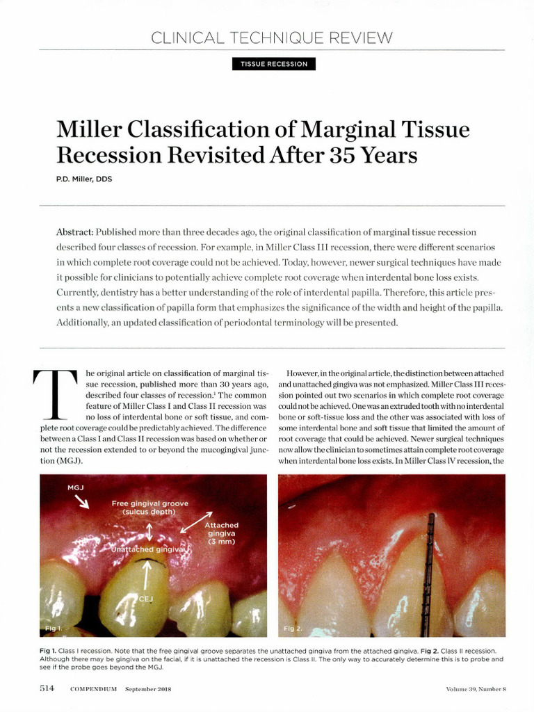 Miller Classification of Marginal Tissue | PDF | Periodontology ...
