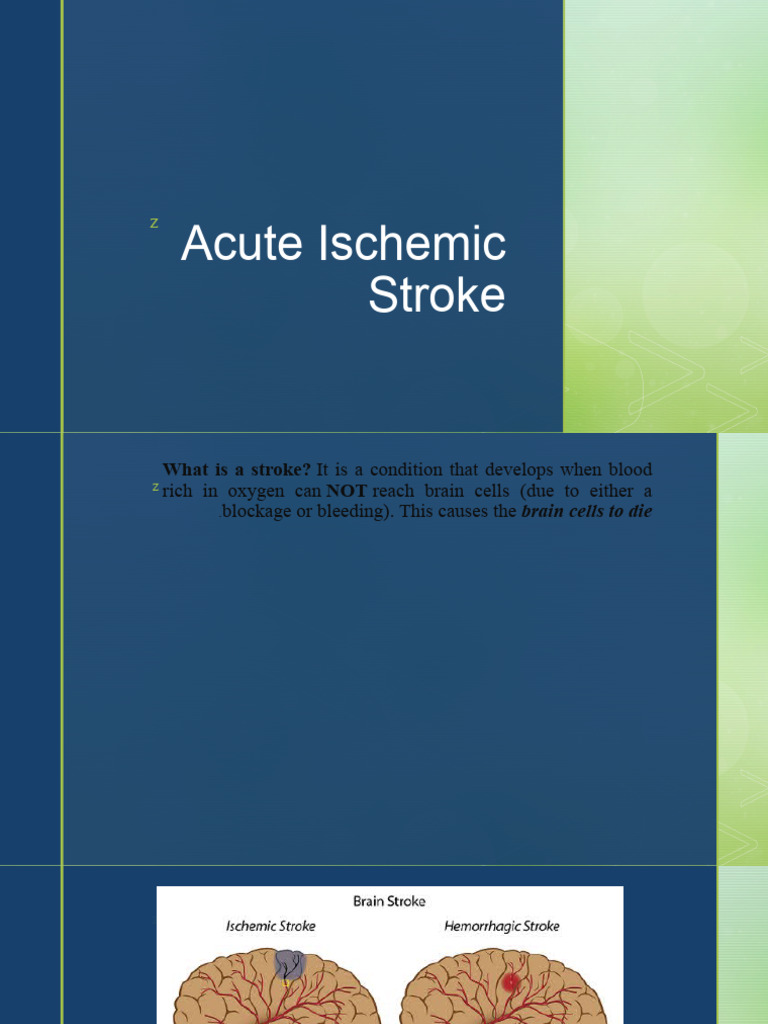 Acute Ischemic Stroke | PDF | Stroke | Ischemia