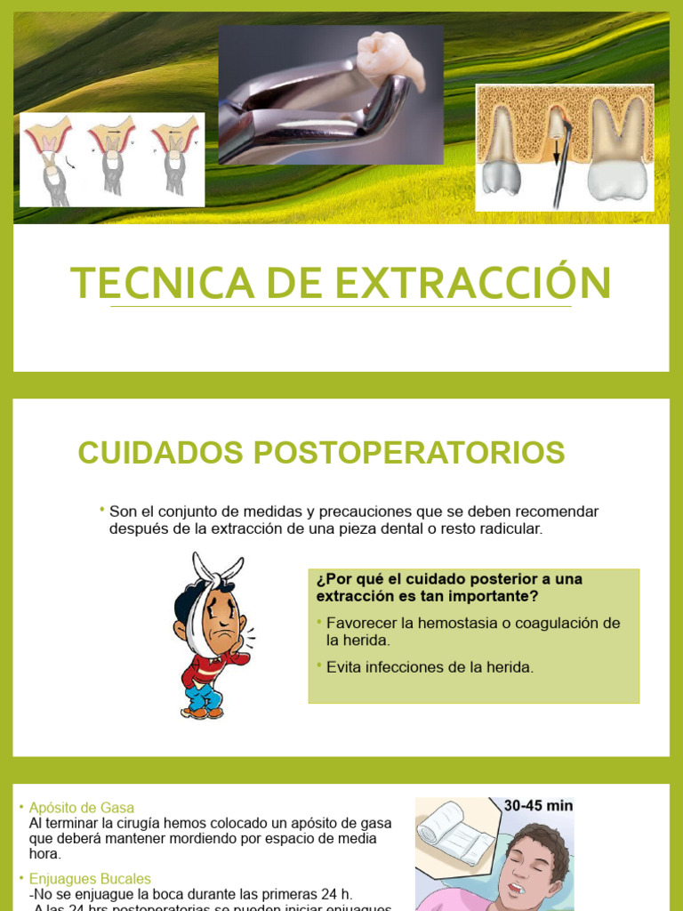 TECNICA DE EXTRACCIÓN 01 | PDF