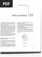 Mano de Predicador | PDF | Mano | Anatomía humana