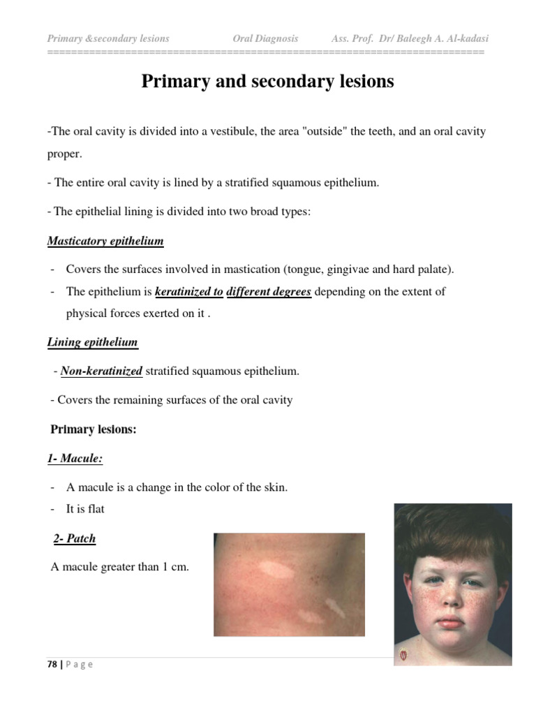 Oral Primary and Secondary Lesions Guide | PDF | Epithelium | Dermatology