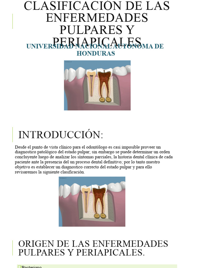 10clasificación de Las Enfermedades Pulpares y Periapicales | PDF ...
