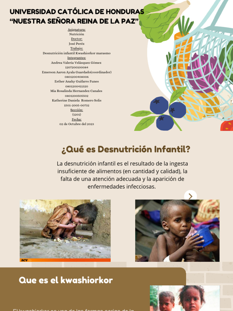 Desnutrición infantil kwashiorkor marasmo | PDF | Epidemiología ...