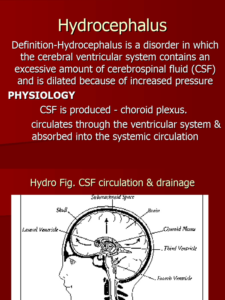 Hydrocephalus | PDF | Cerebrospinal Fluid | Brain