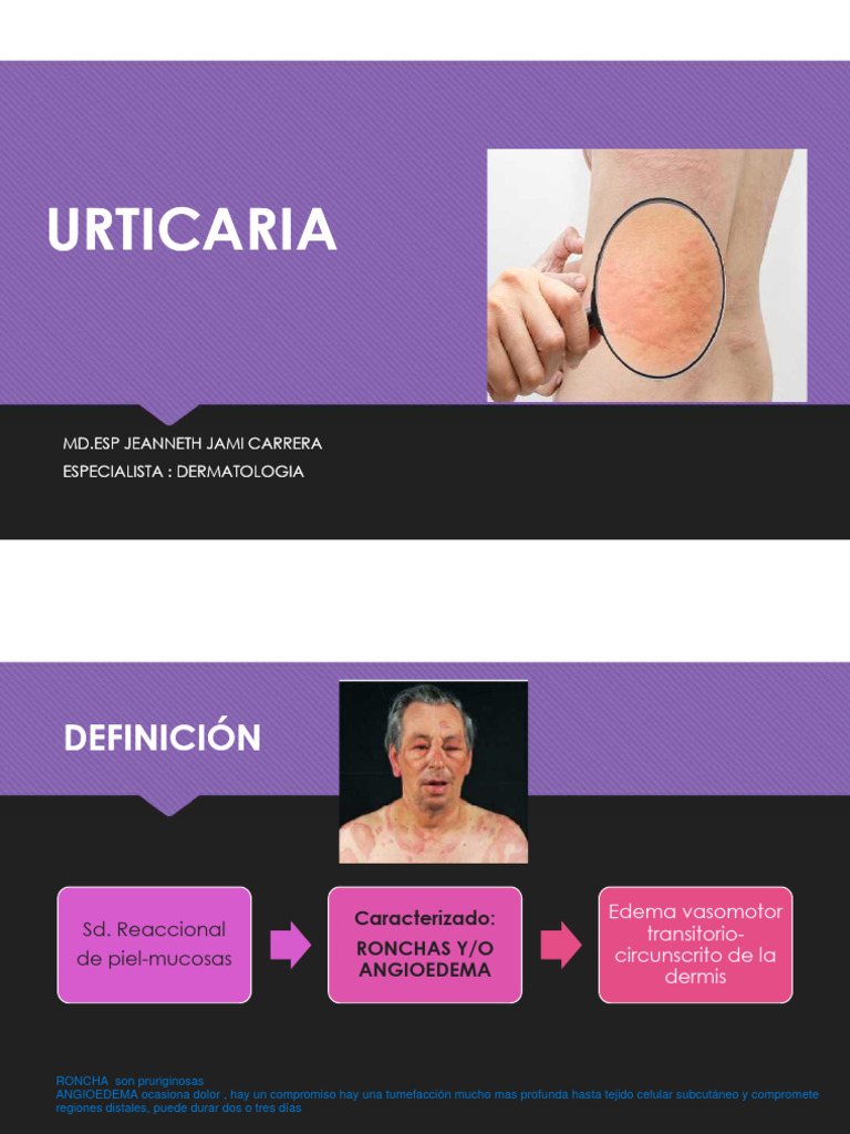 Urticaria Diapos | PDF | Sistema inmune | Inmunología