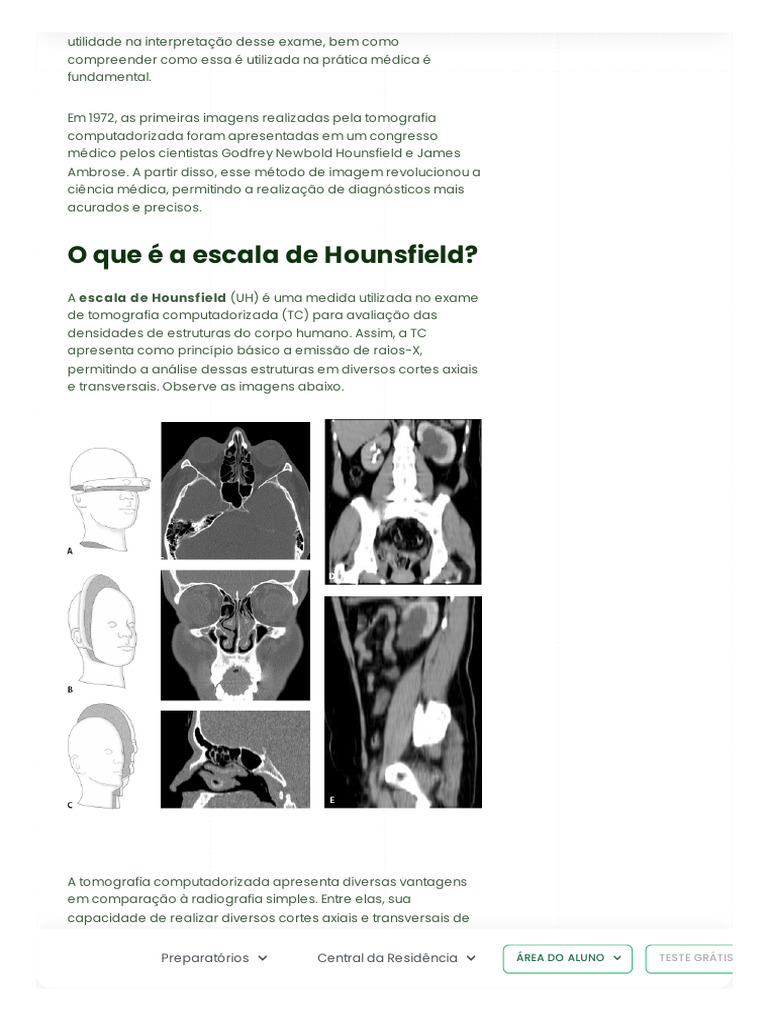 Escala de Hounsfield - o Que É, Estágios e Tratamento | PDF ...